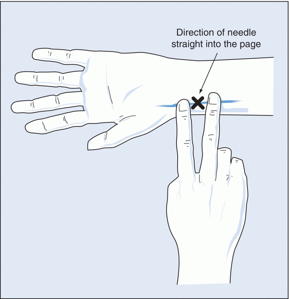PRACTICAL PROCEDURES | Basicmedical Key