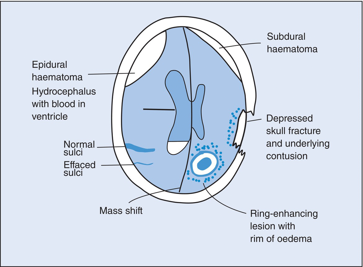 RADIOLOGY | Basicmedical Key