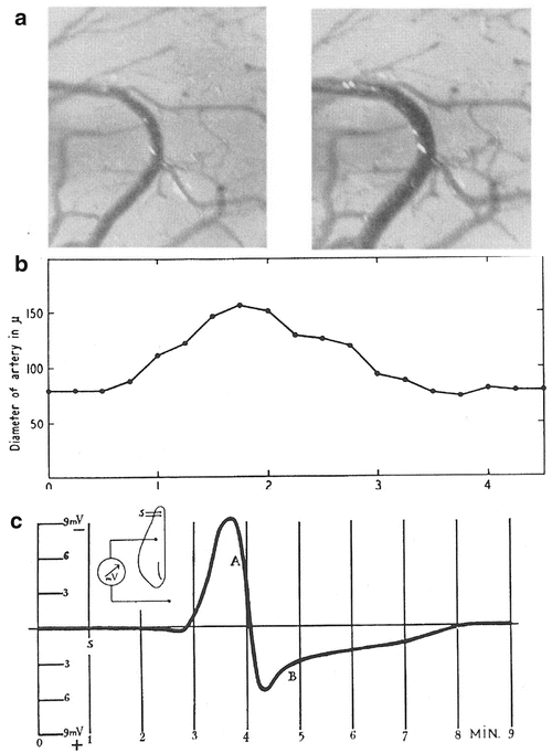 Responses of NADH to Physiological and Pathophysiological Conditions ...