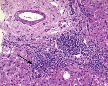 Liver | Basicmedical Key