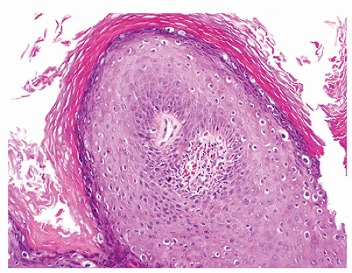 Vulva and Vagina | Basicmedical Key