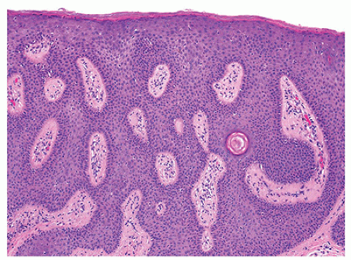 Vulva and Vagina | Basicmedical Key