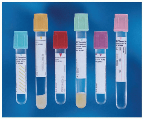 Blood Studies: Hematology and Coagulation | Basicmedical Key