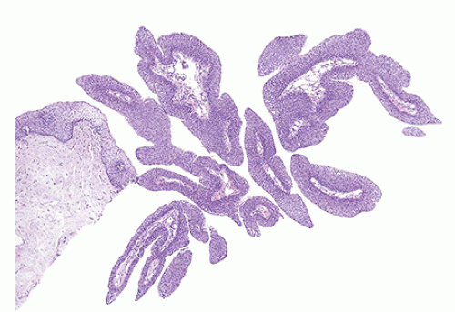 Cervix | Basicmedical Key