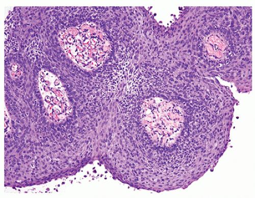 Cervix | Basicmedical Key