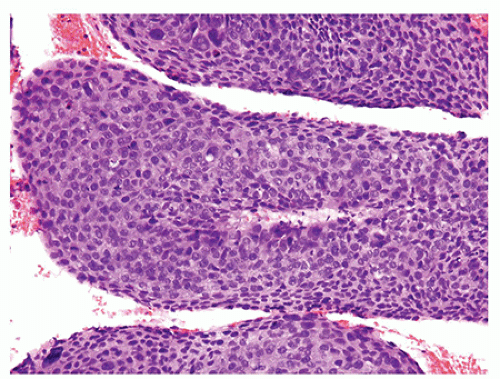 Cervix | Basicmedical Key