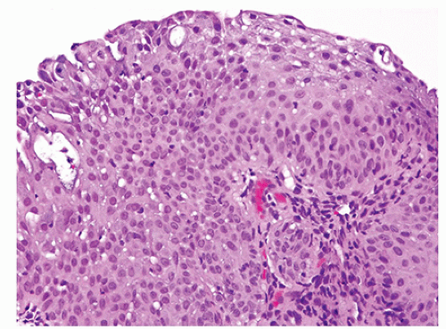 Cervix | Basicmedical Key