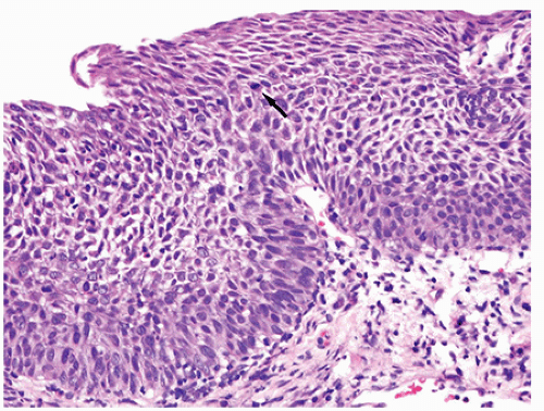 Cervix | Basicmedical Key
