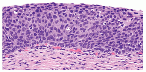 Cervix | Basicmedical Key