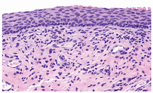 Cervix | Basicmedical Key