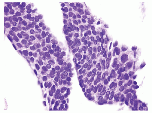 Cervix | Basicmedical Key