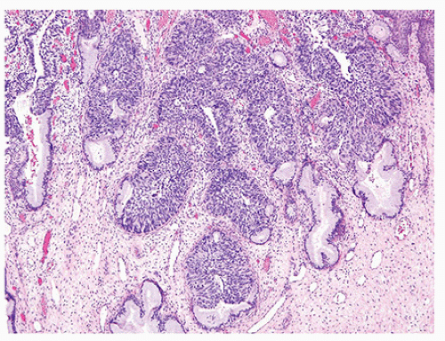 Cervix | Basicmedical Key