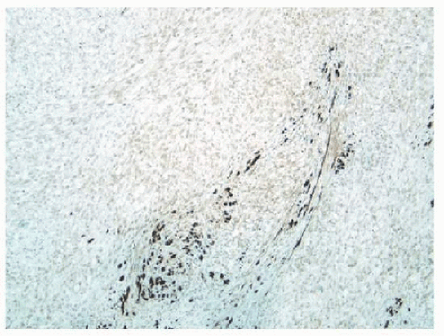 Neck/Soft Tissue | Basicmedical Key