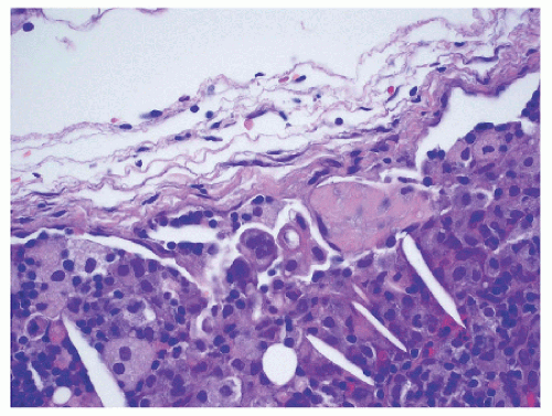 Sentinel Lymph Nodes | Basicmedical Key