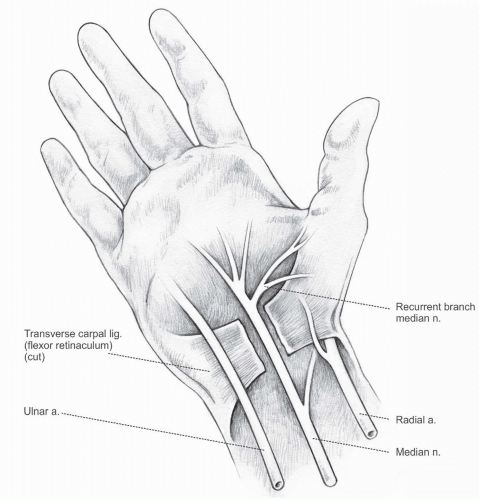 Breast and Neurovascular System of the Upper Extremity | Basicmedical Key