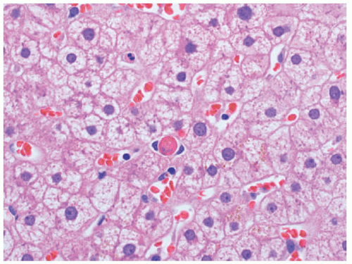 The Language of Liver Pathology: Definitions of Key Terms ...