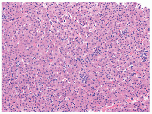 The Language of Liver Pathology: Definitions of Key Terms ...