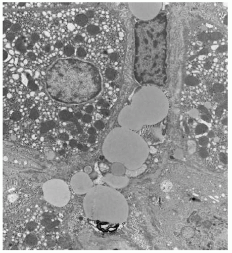 Electron Microscopy | Basicmedical Key