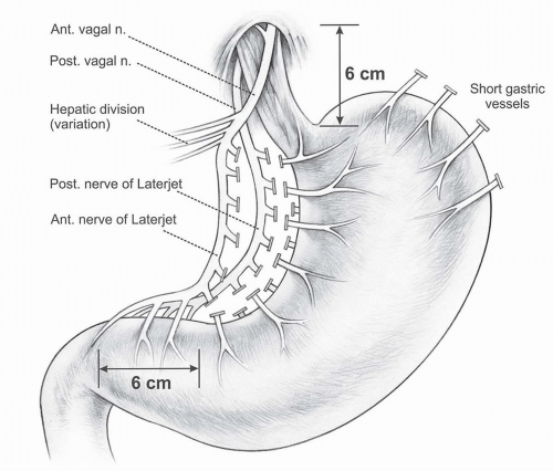 Stomach, Duodenum, and Esophagus | Basicmedical Key
