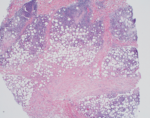 Cutaneous Lupus Erythematosus | Basicmedical Key