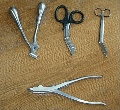 Casts for Children’s Fractures | Basicmedical Key