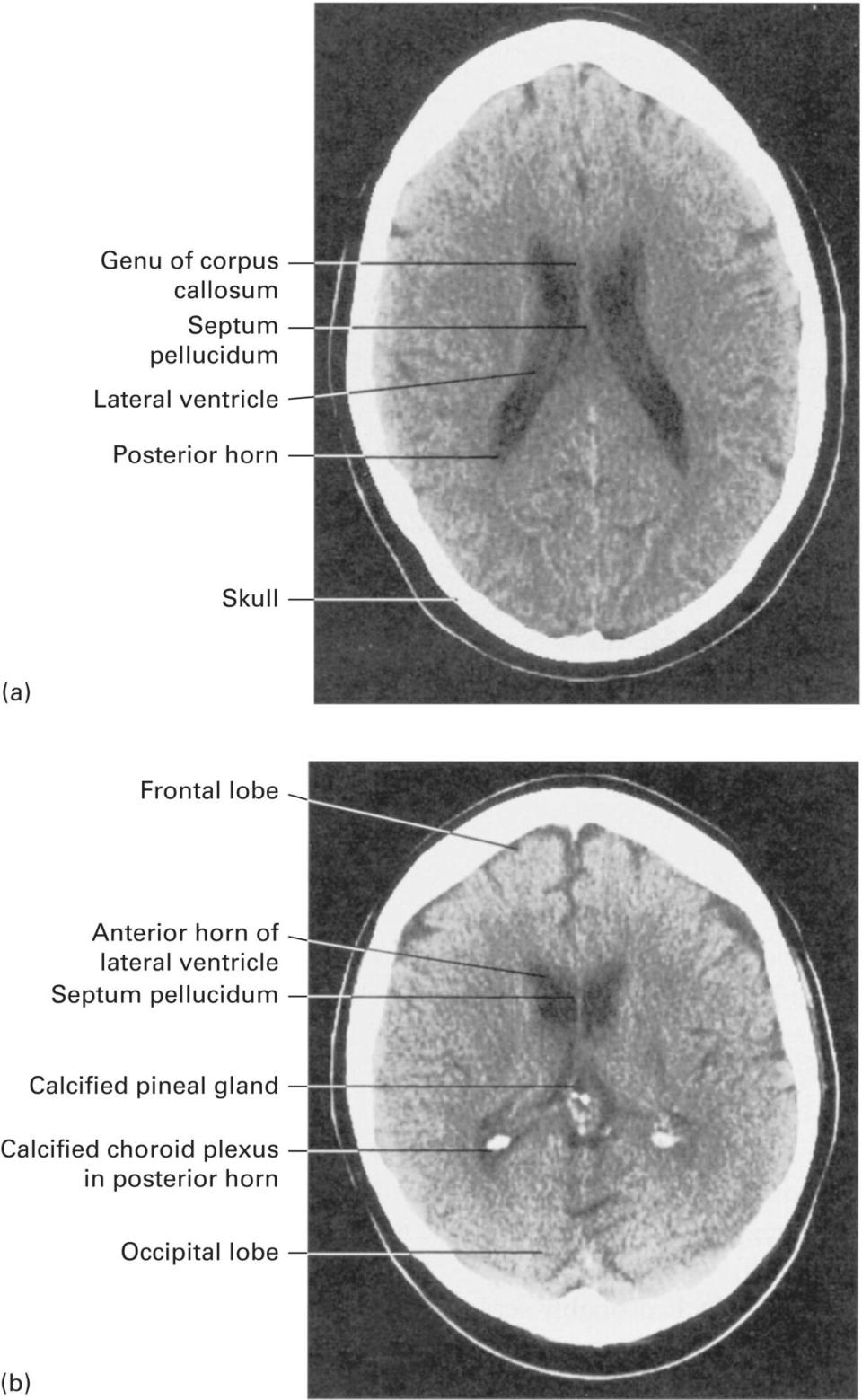 6: The Nervous System | Basicmedical Key