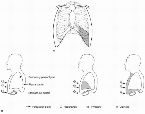 The Chest | Basicmedical Key