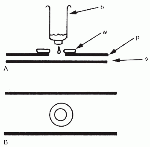 Some Bedside Laboratory Tricks | Basicmedical Key