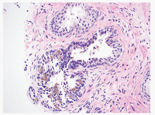 Prostate | Basicmedical Key