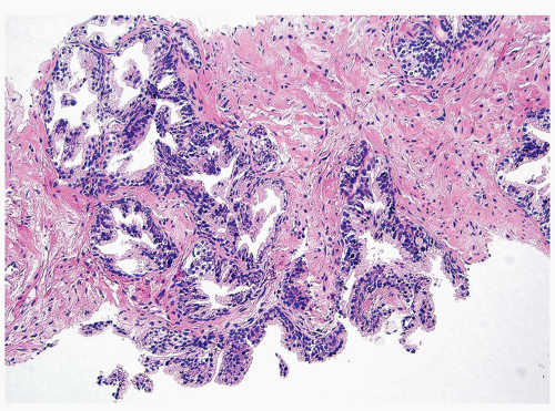 Prostate | Basicmedical Key