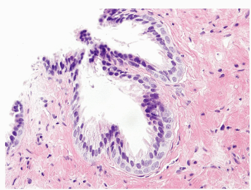 Prostate | Basicmedical Key
