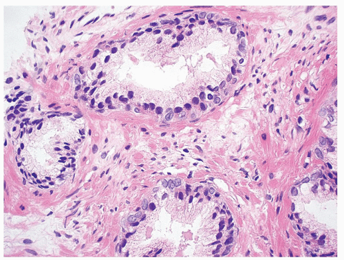 Prostate | Basicmedical Key