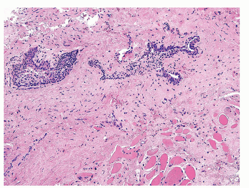 Prostate | Basicmedical Key