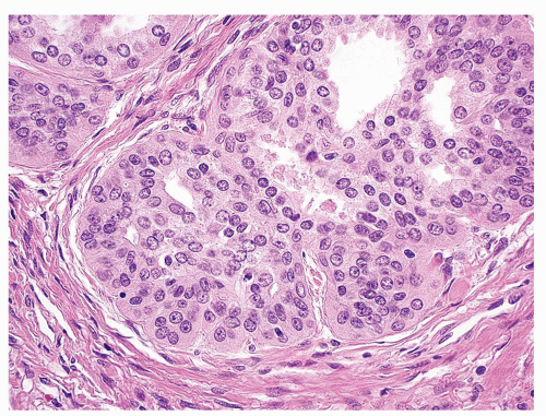 Prostate | Basicmedical Key