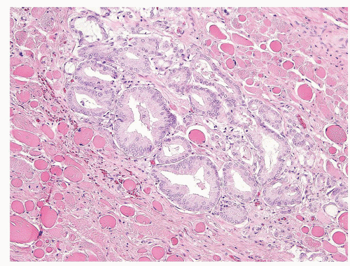 Prostate | Basicmedical Key