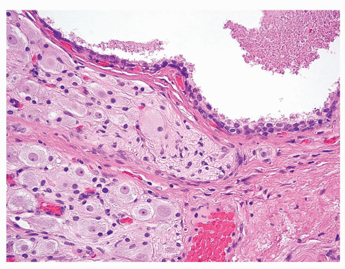 Prostate | Basicmedical Key