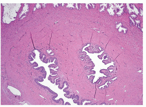 Prostate | Basicmedical Key