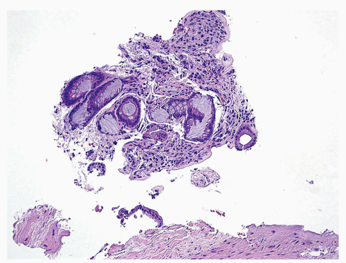 Prostate | Basicmedical Key