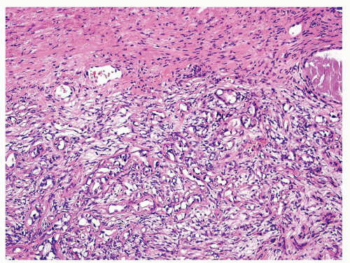 Prostate | Basicmedical Key