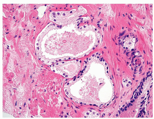 Prostate | Basicmedical Key