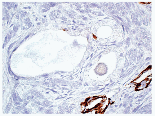 Prostate | Basicmedical Key