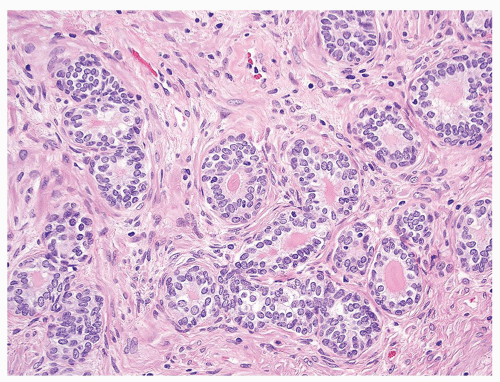 Prostate | Basicmedical Key