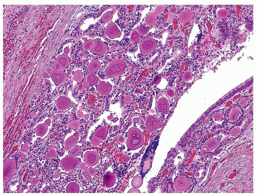 Prostate | Basicmedical Key