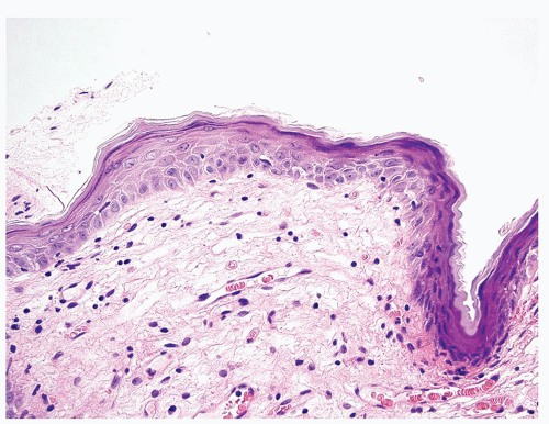 Bladder | Basicmedical Key