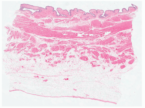 Bladder | Basicmedical Key