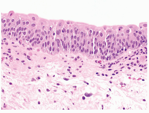 Bladder | Basicmedical Key