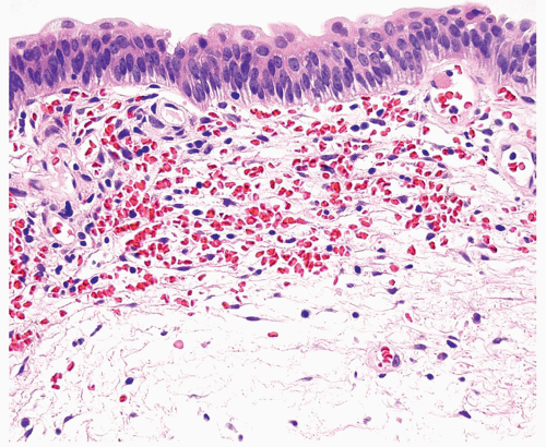 Bladder | Basicmedical Key