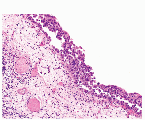 Bladder | Basicmedical Key