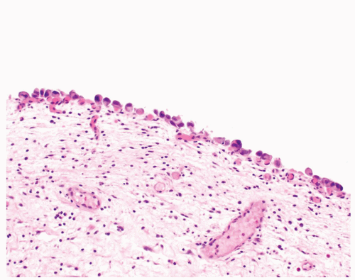Bladder | Basicmedical Key