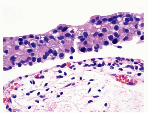 Bladder | Basicmedical Key